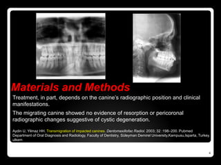 Transmigration of permanent mandibular canines | PDF