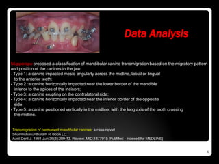 Transmigration of permanent mandibular canines | PDF