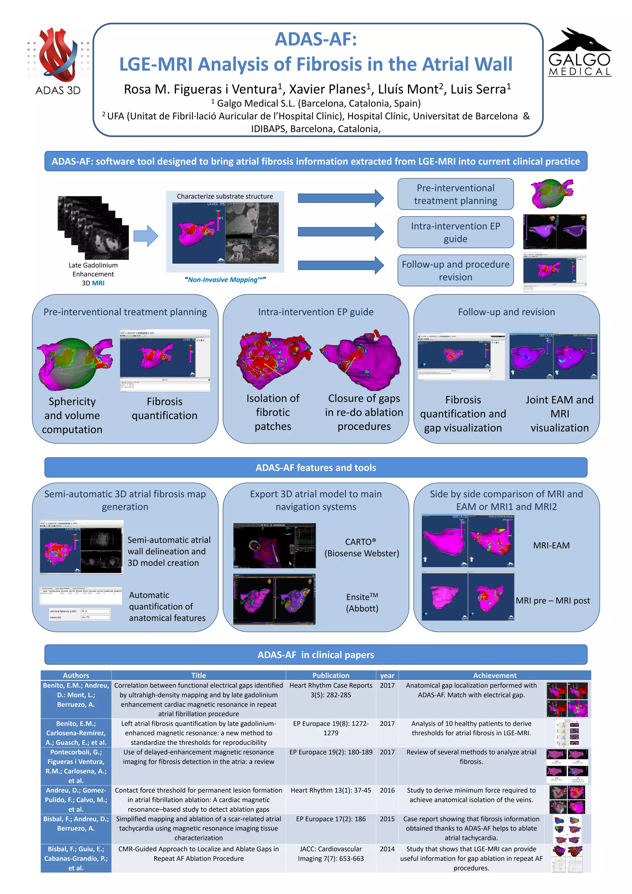 Poster atrial signals | PDF | Heart and Cardiovascular Diseases ...