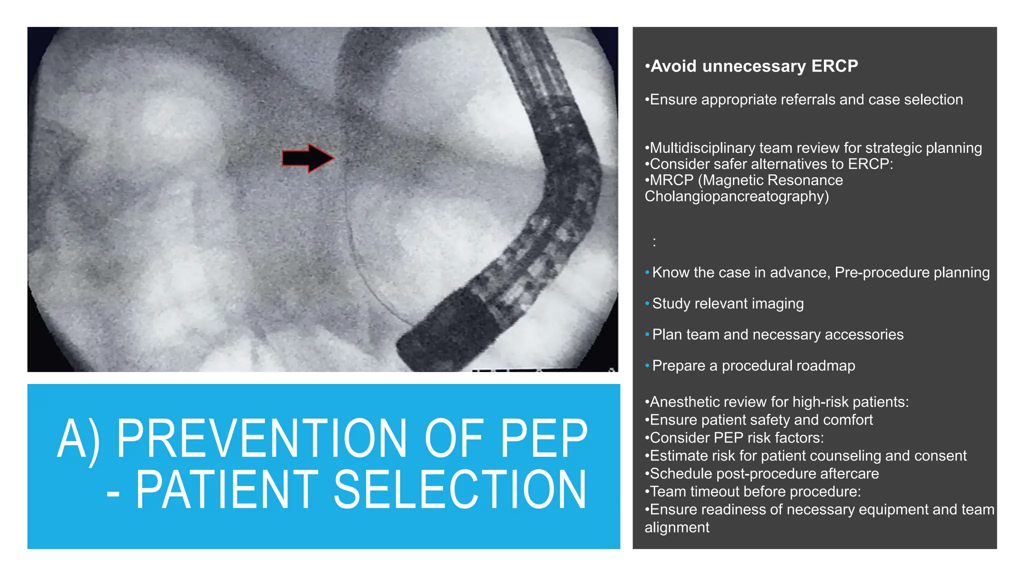 POST ERCP PANCREATITIS- RISK FACTORS / PREVENTION / TREATMENT | PPTX