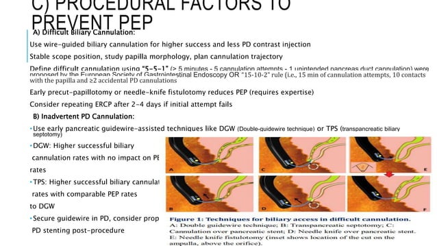 POST ERCP PANCREATITIS- RISK FACTORS / PREVENTION / TREATMENT | PPTX