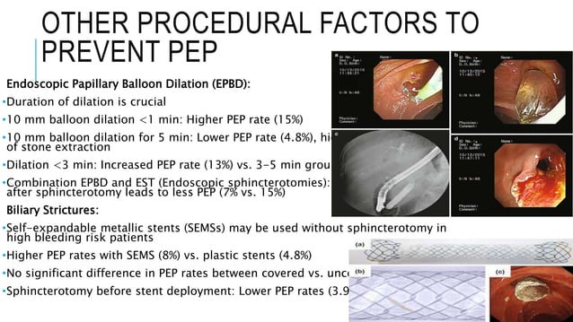 POST ERCP PANCREATITIS- RISK FACTORS / PREVENTION / TREATMENT | PPTX