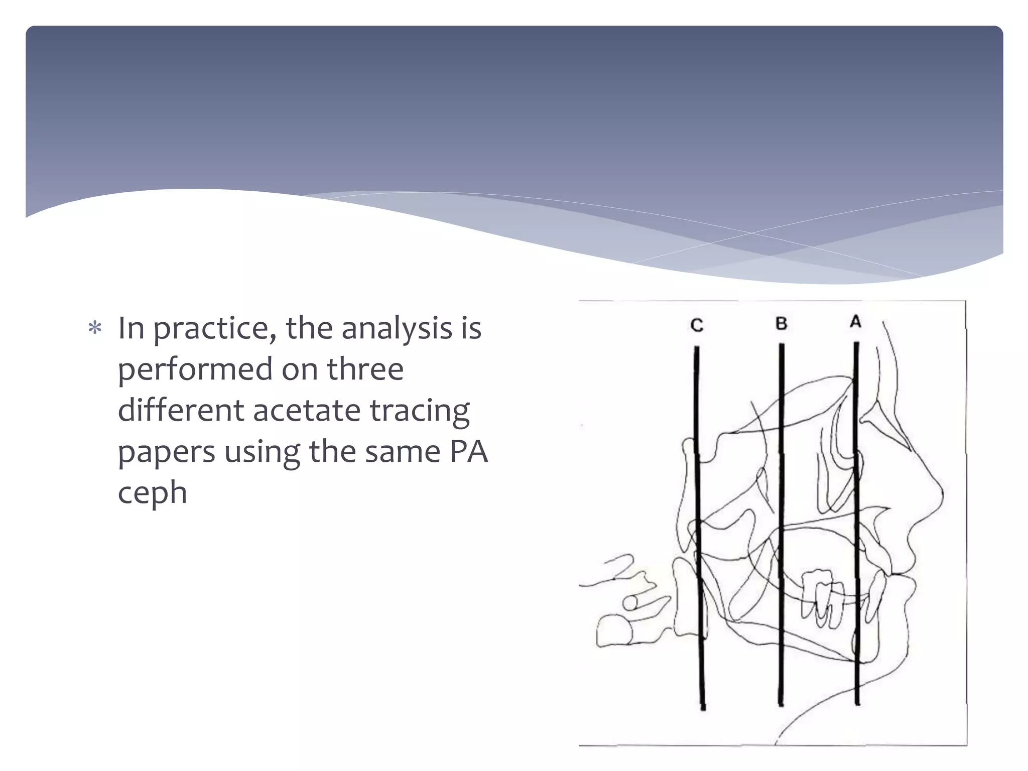 Posterio anterior cephalometric analysis | PPTX