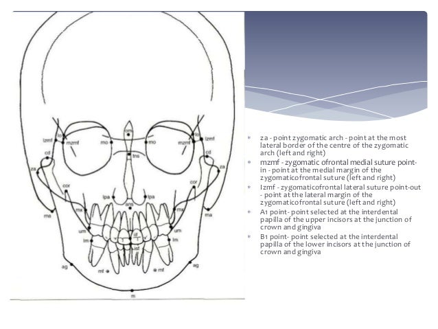 Cephalometric Tracing Program - souprewards