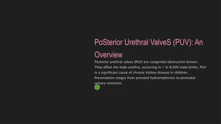 Posterior-Urethral-Valves-PUV-An-Overview (1).pptx
