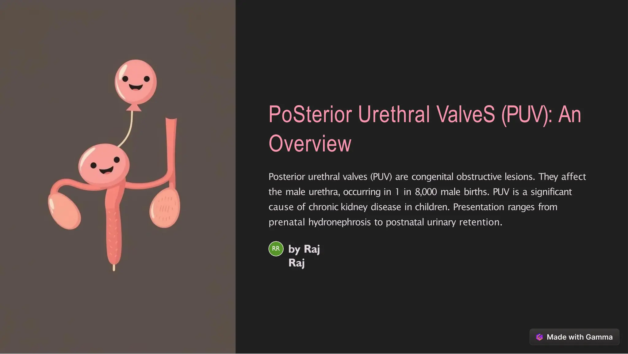 Posterior-Urethral-Valves-PUV-An-Overview (2).pptx
