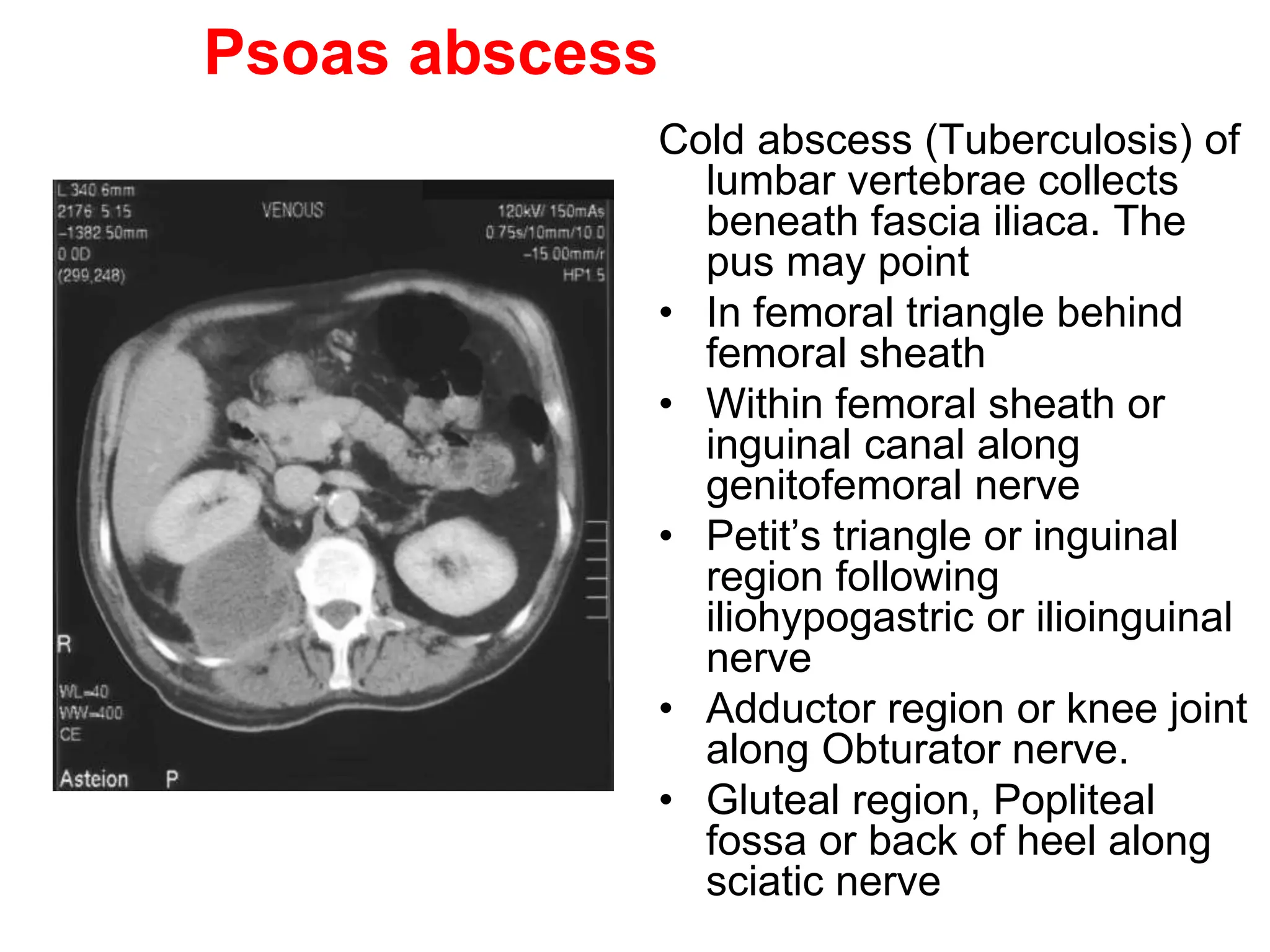 Posterior abdominal.wall.pptx anatomy... | PPTX