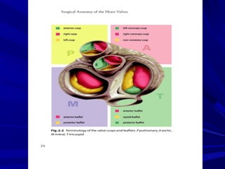 Posterior approach aortic root enlargement in redo aortic | PPT