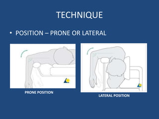 Posterior approach to humerus | PPTX