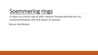 Posterior Capsular Opacification.pptx