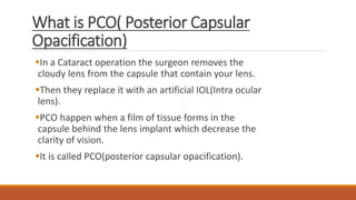 Posterior Capsular Opacification.pptx