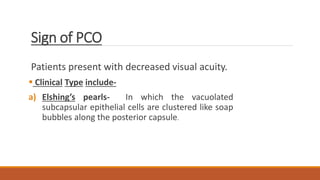 Posterior Capsular Opacification.pptx