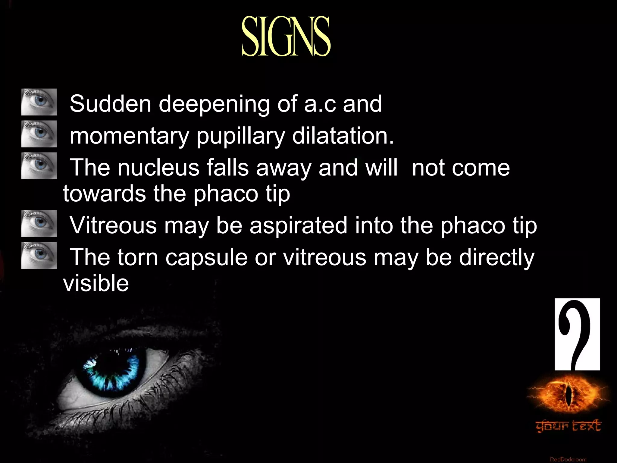 Posterior capsular rupture | PPT