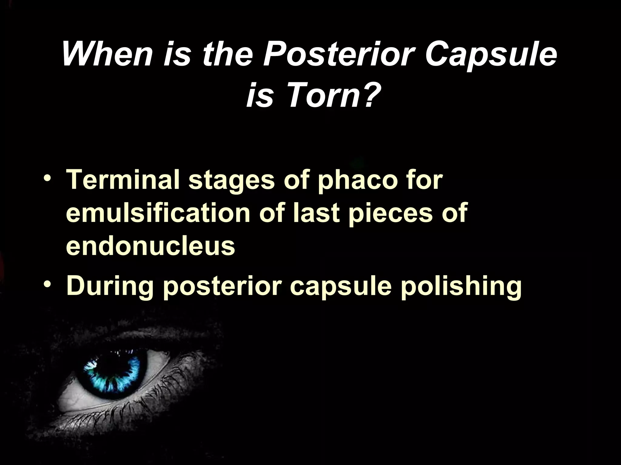 Posterior capsular rupture | PPT