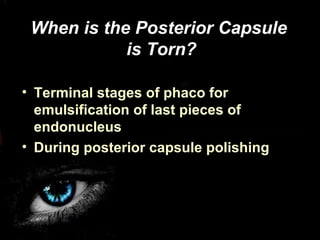 Posterior capsular rupture | PPT