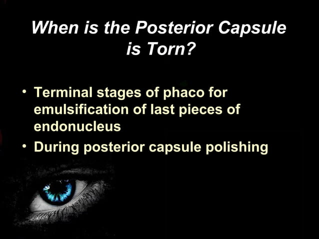 Posterior capsular rupture | PPT | Eye and Vision Conditions | Diseases ...