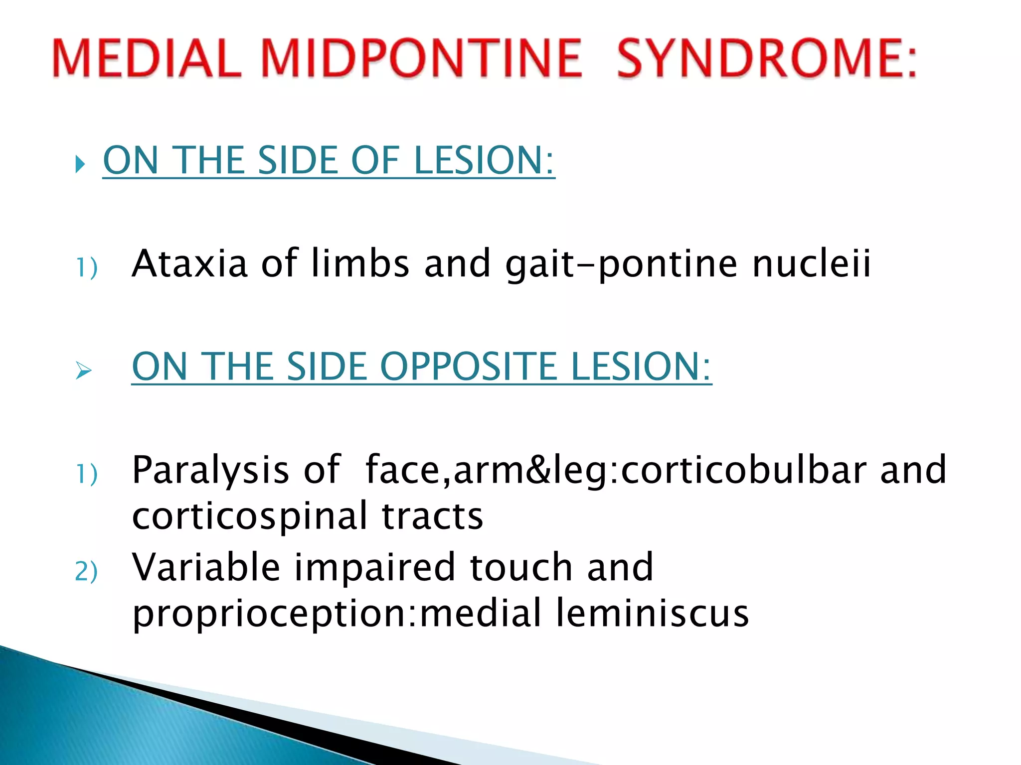Posterior circulation stroke | PPTX