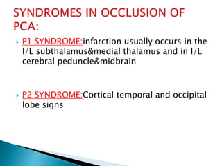 Posterior circulation stroke | PPTX