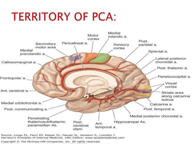 Posterior circulation stroke