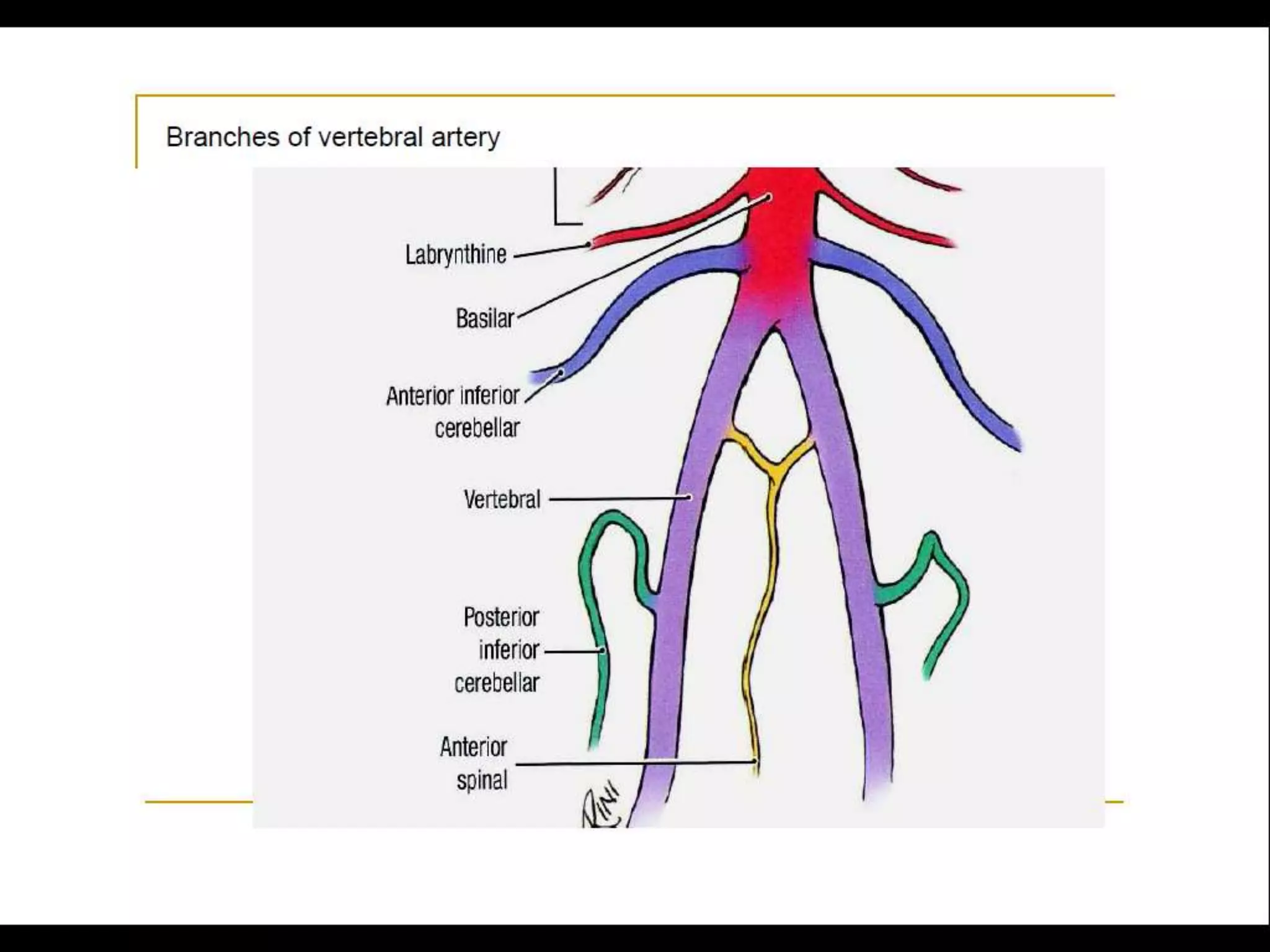 Posterior circulation stroke Syndromes | PPTX