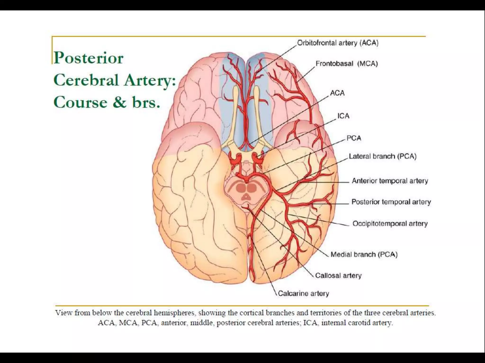 Posterior circulation stroke Syndromes | PPTX