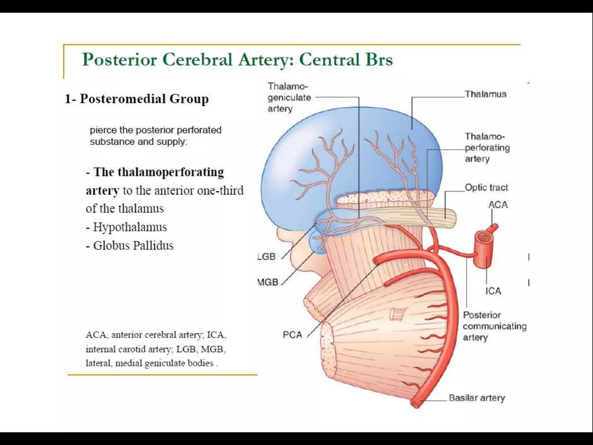 Posterior circulation stroke Syndromes | PPTX