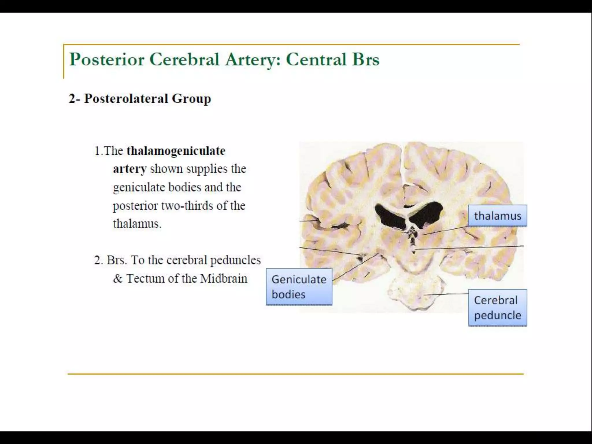 Posterior circulation stroke Syndromes | PPTX