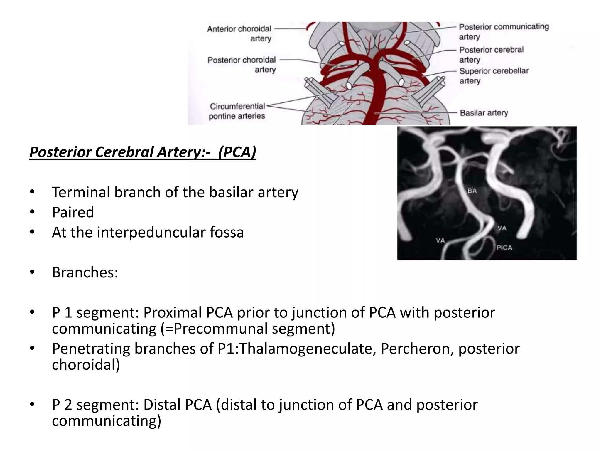Posterior circulation stroke Syndromes | PPTX
