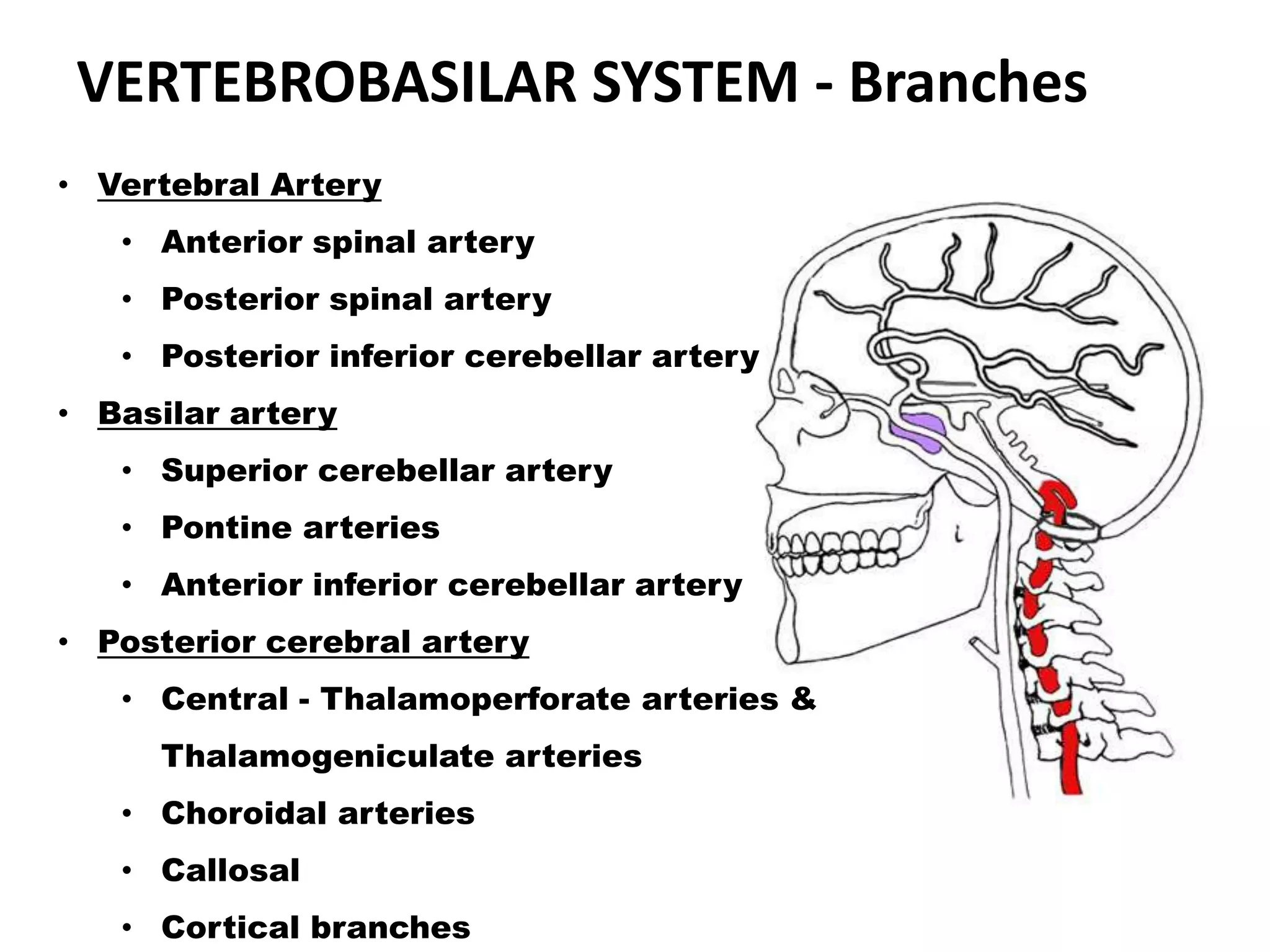 Posterior circulation stroke Syndromes | PPTX