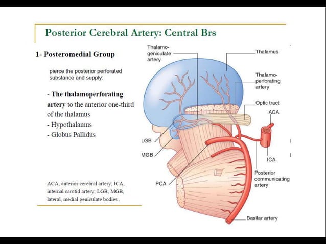 Posterior circulation stroke Syndromes | PPTX | Brain and Nervous ...