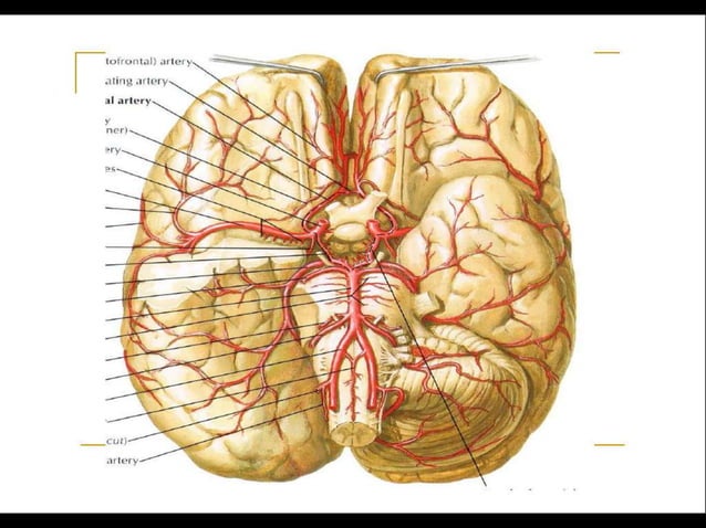 Posterior circulation stroke Syndromes | PPTX | Brain and Nervous ...