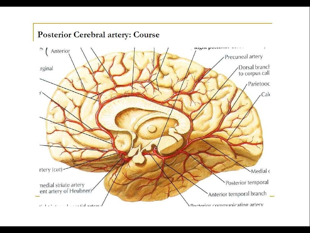 Posterior circulation stroke Syndromes