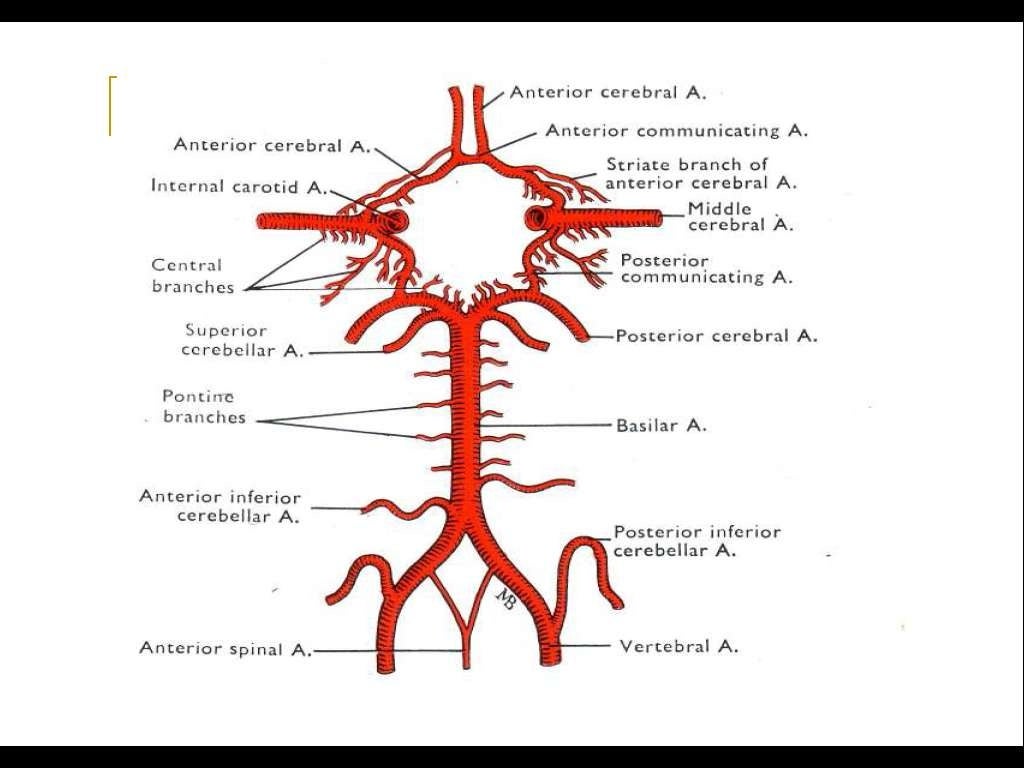 Posterior circulation stroke Syndromes
