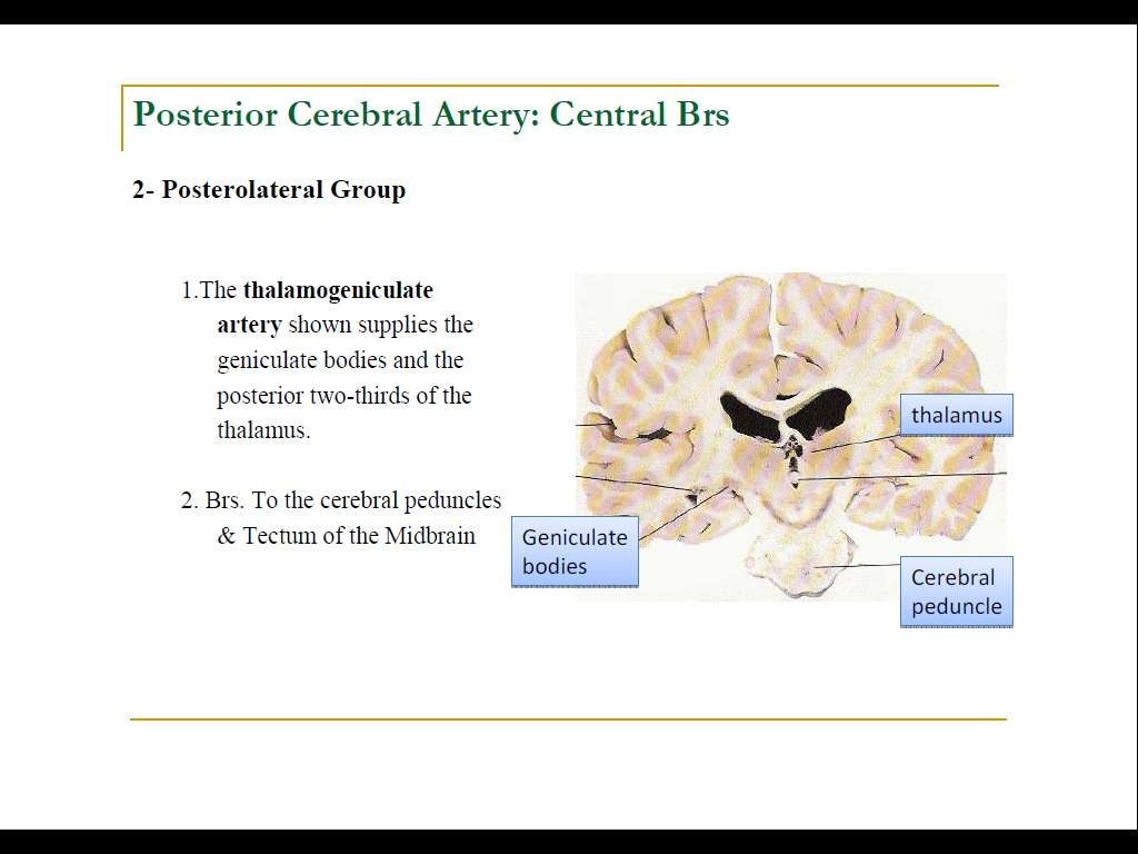 Posterior circulation stroke Syndromes