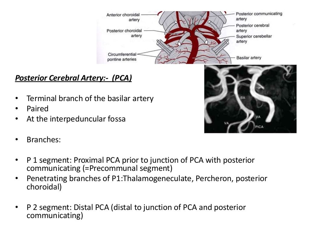 Posterior circulation stroke Syndromes