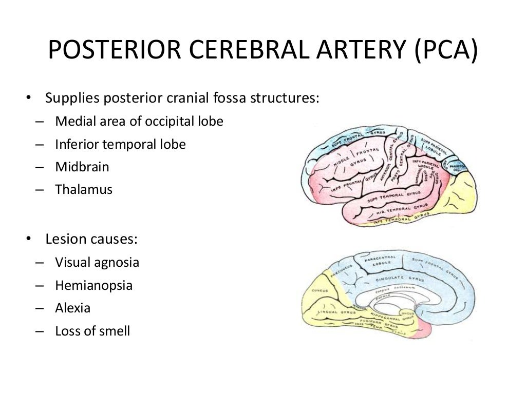 Posterior circulation stroke Syndromes