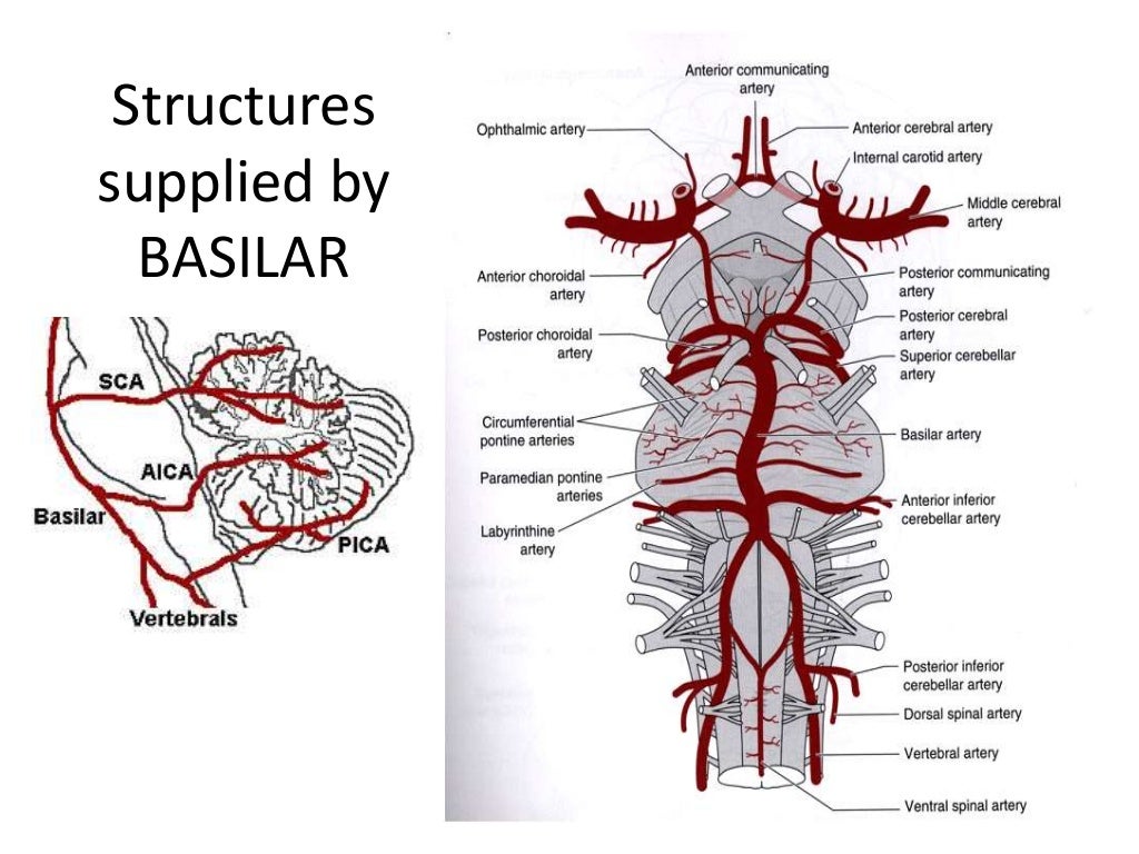 Posterior circulation stroke Syndromes