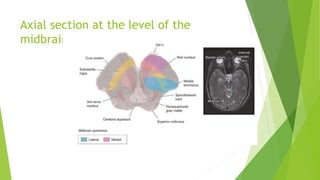 posterior circulation stroke.pptx