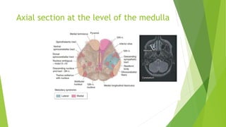 posterior circulation stroke.pptx
