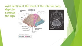 posterior circulation stroke.pptx