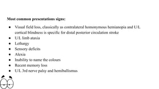 posterior circulation ischemic/embolic stroke | PDF