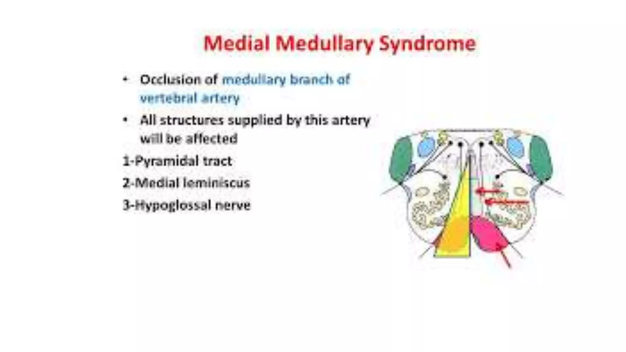 Posterior circulation stroke syndromes - Dr Sameep Koshti (consultant ...