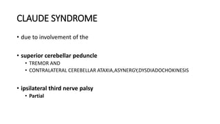 Posterior circulation stroke syndromes - Dr Sameep Koshti (consultant ...