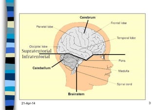 Anaesthesia Management of Posterior cranial fossa surgeries | PPTX