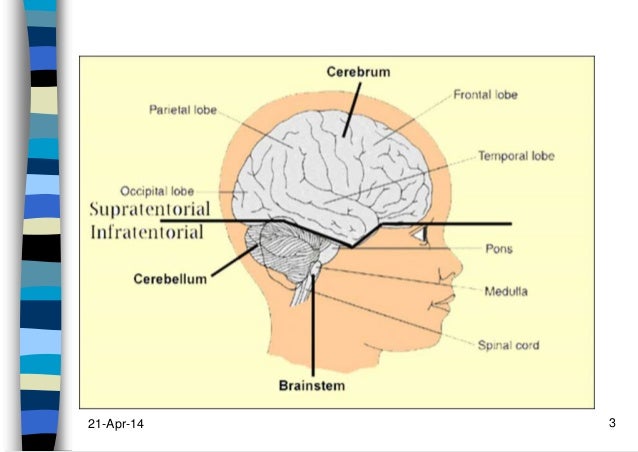Anaesthesia Management of Posterior cranial fossa surgeries