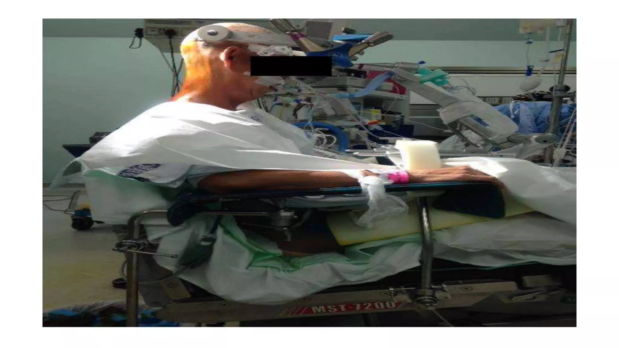 posterior cranial fossa surgery and anaesthesia | PPTX