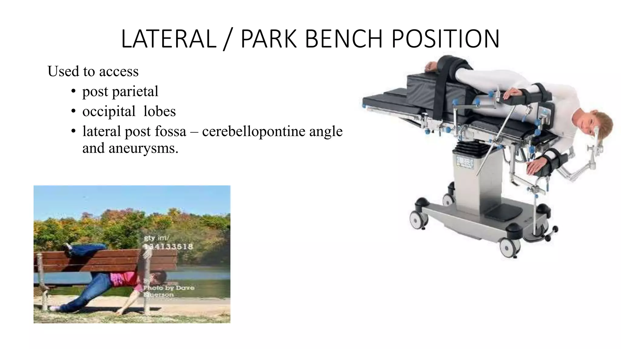 posterior cranial fossa surgery and anaesthesia | PPTX