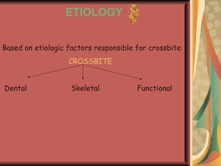 Posterior crossbite in_primary_and_mixed_dentition_-_etiology_and ...