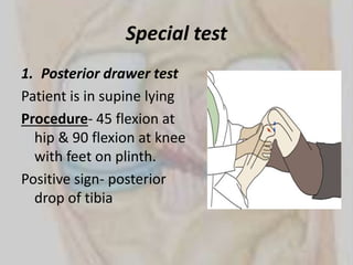 Posterior cruciate liagment.pptx