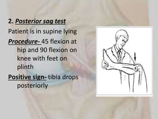 Posterior cruciate liagment.pptx